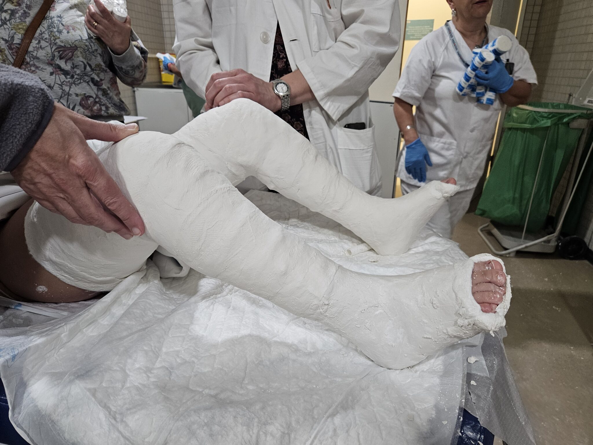 Método Ponseti – Asociación Ponseti España